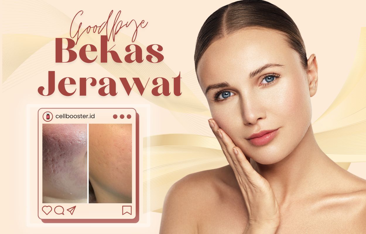 8 Bahan Alami yang Bantu Memudarkan Bekas Jerawat - ST Indonesia