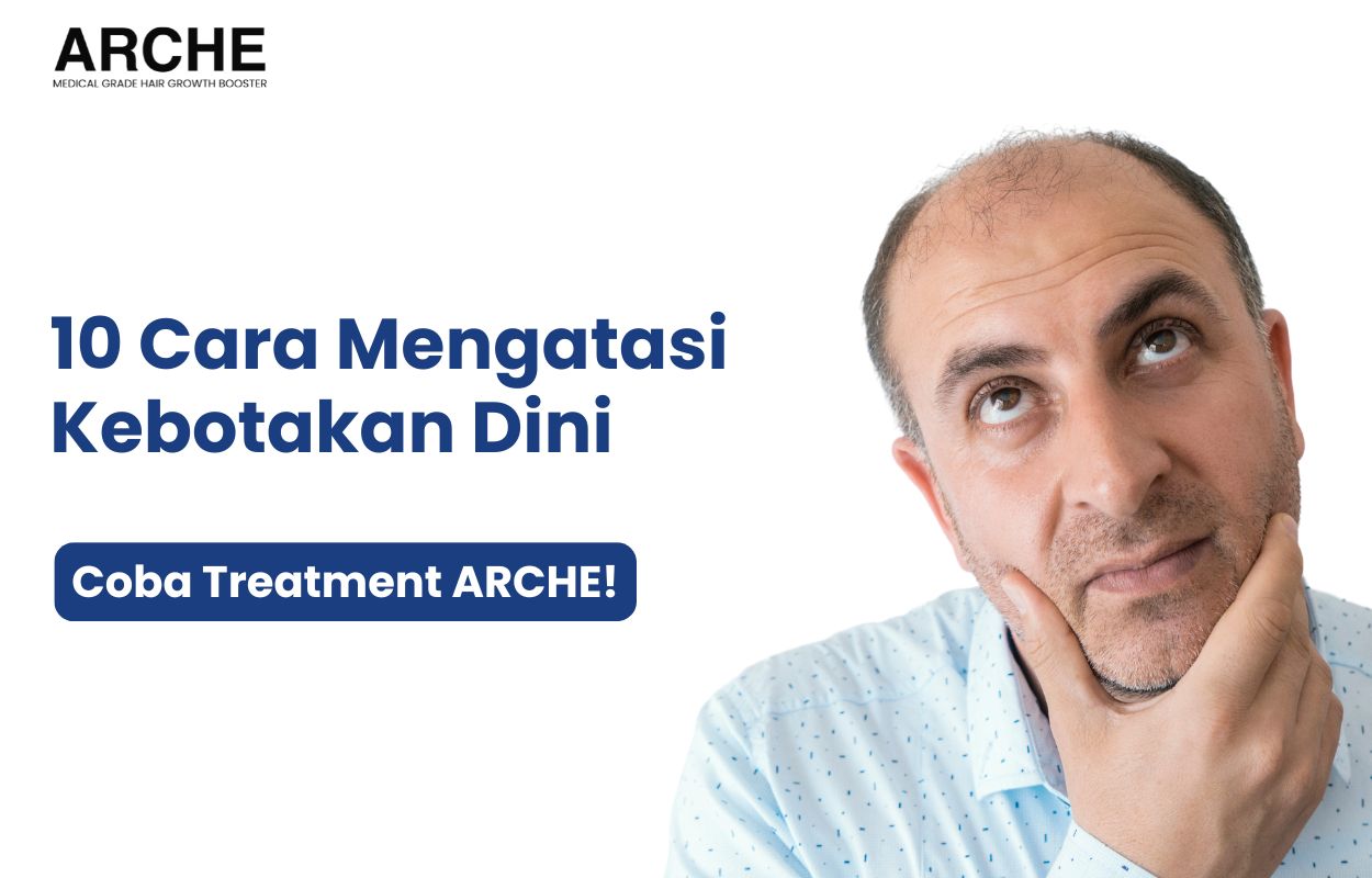 11 Cara Mengatasi Kebotakan Dini pada Pria, Coba Treatment ARCHE! - ST ...