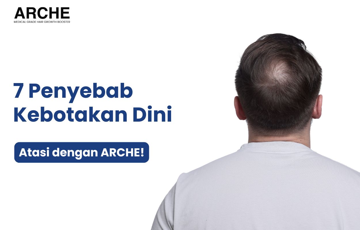 7 Penyebab Kebotakan Dini dan Cara Mengatasinya, Coba Treatment ARCHE! - ST Indonesia