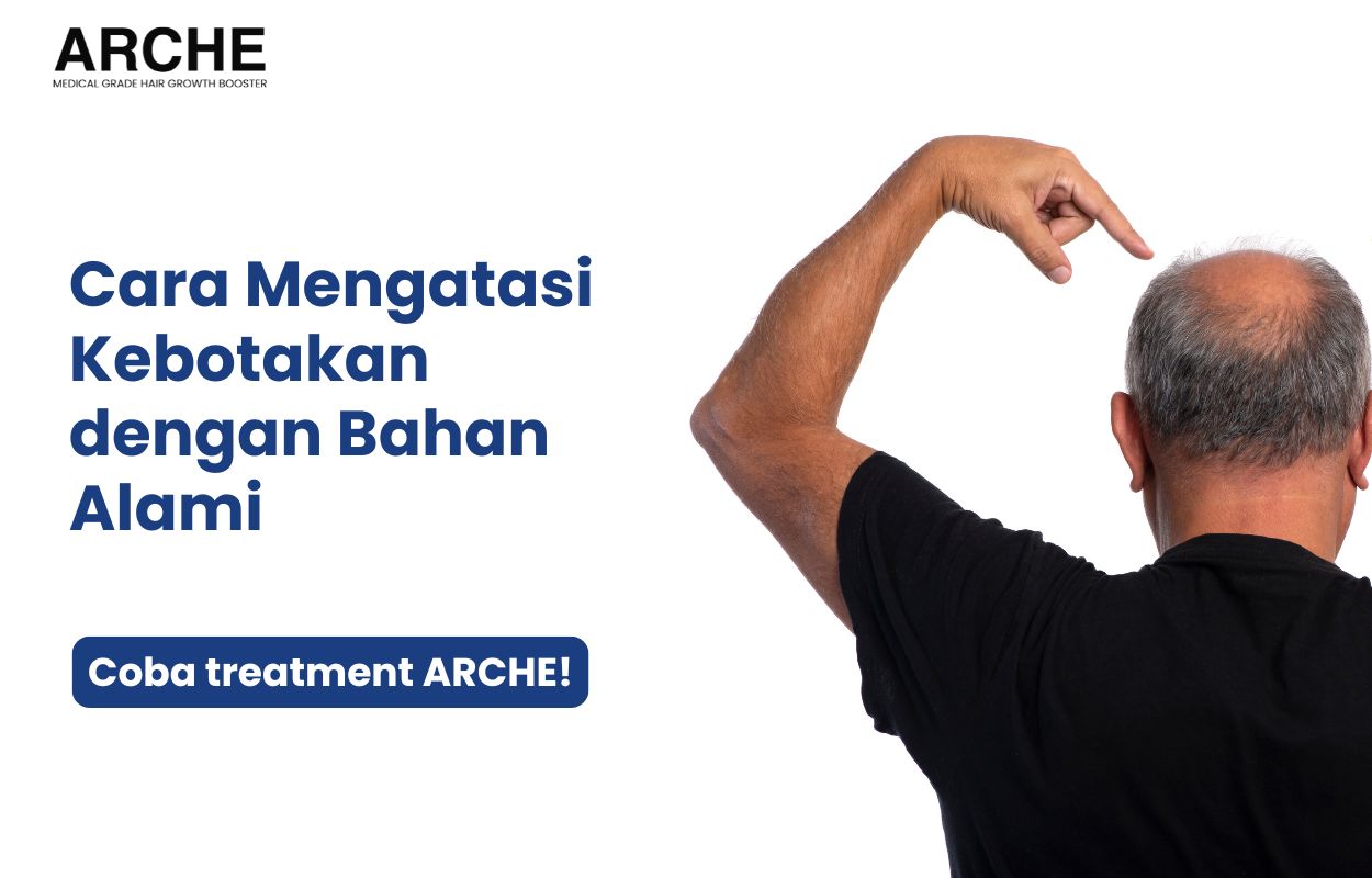10 Cara Mengatasi Kebotakan dengan Bahan Alami, Coba Treatment ARCHE ...