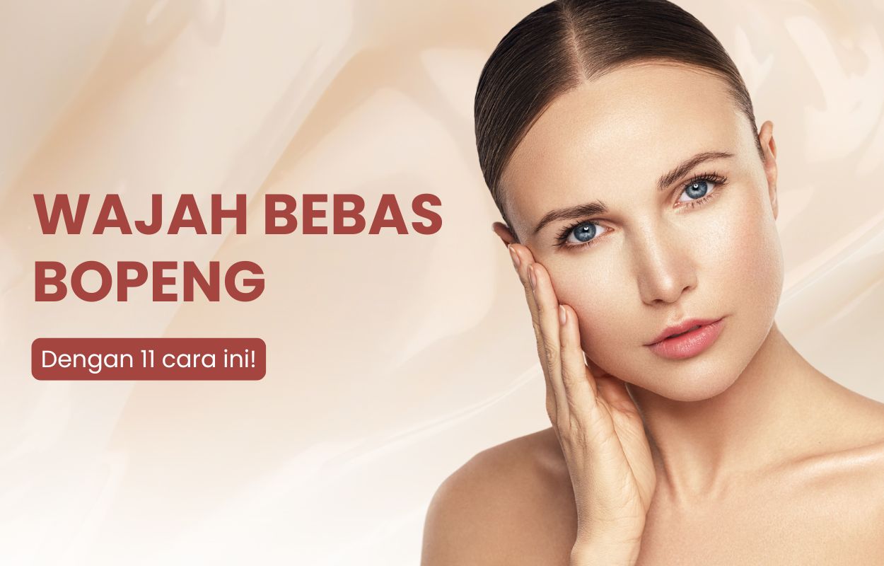Cara Mengatasi Bopeng Bekas Jerawat secara Alami dan Medis - ST Indonesia