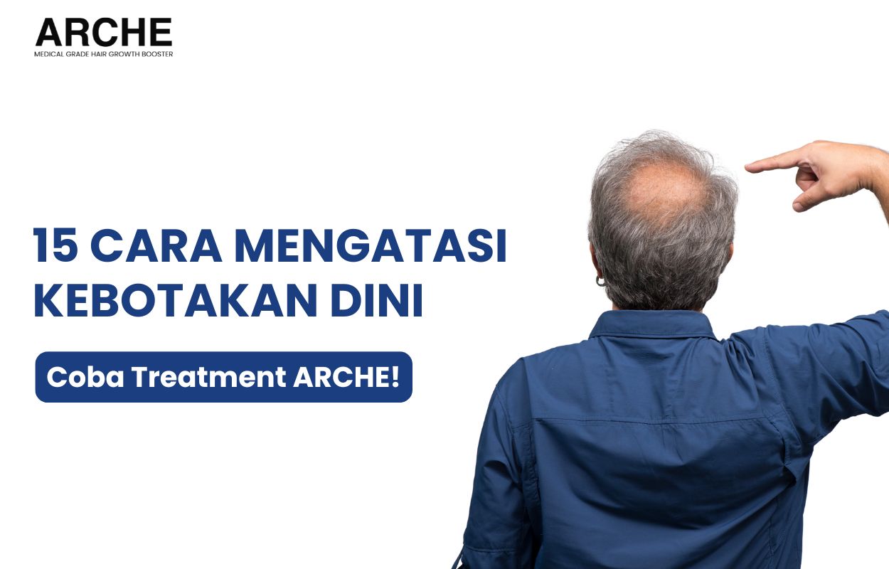 15 Cara Mengatasi Kebotakan Dini Secara Alami dan Medis - ST Indonesia