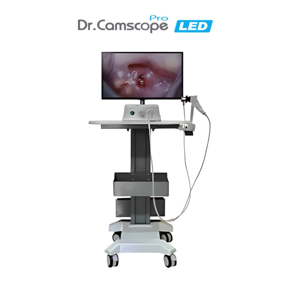 Pemeriksaan Video Colposcopy untuk Diagnosis Kanker Serviks - ST Indonesia
