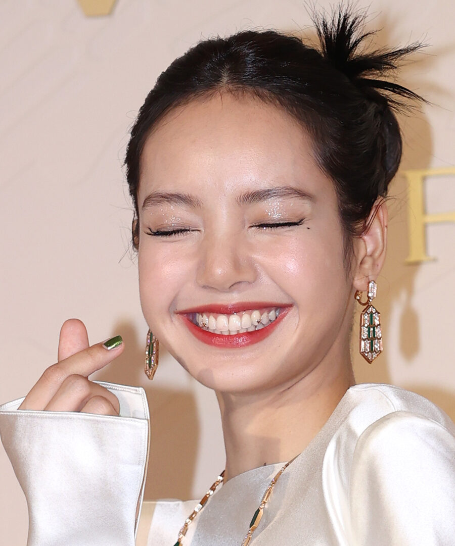 Pasangan Diamond Gigi, Amankah? - ST Indonesia