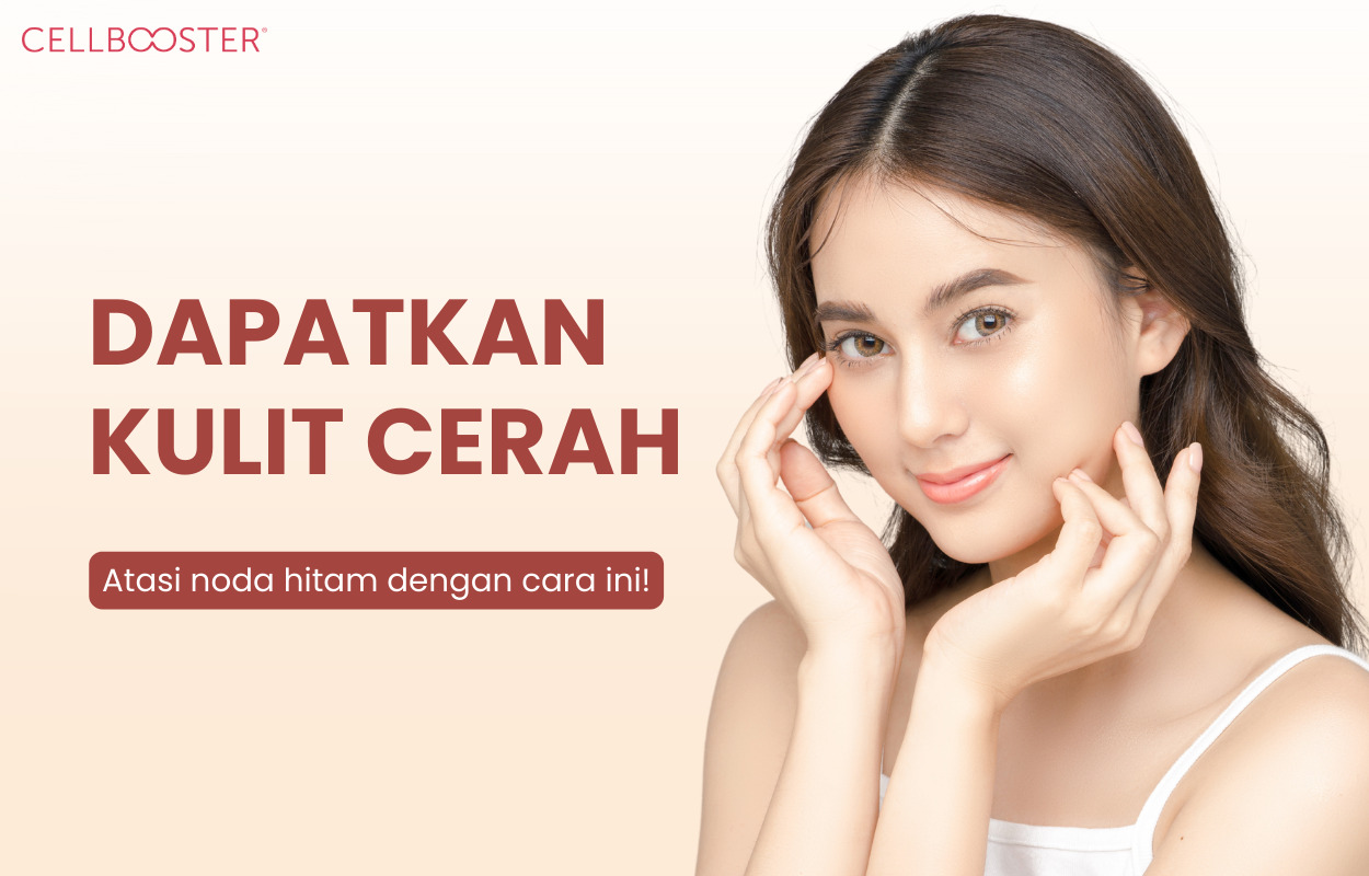 Penyebab Noda Hitam di Wajah dan Cara Mengatasinya - ST Indonesia