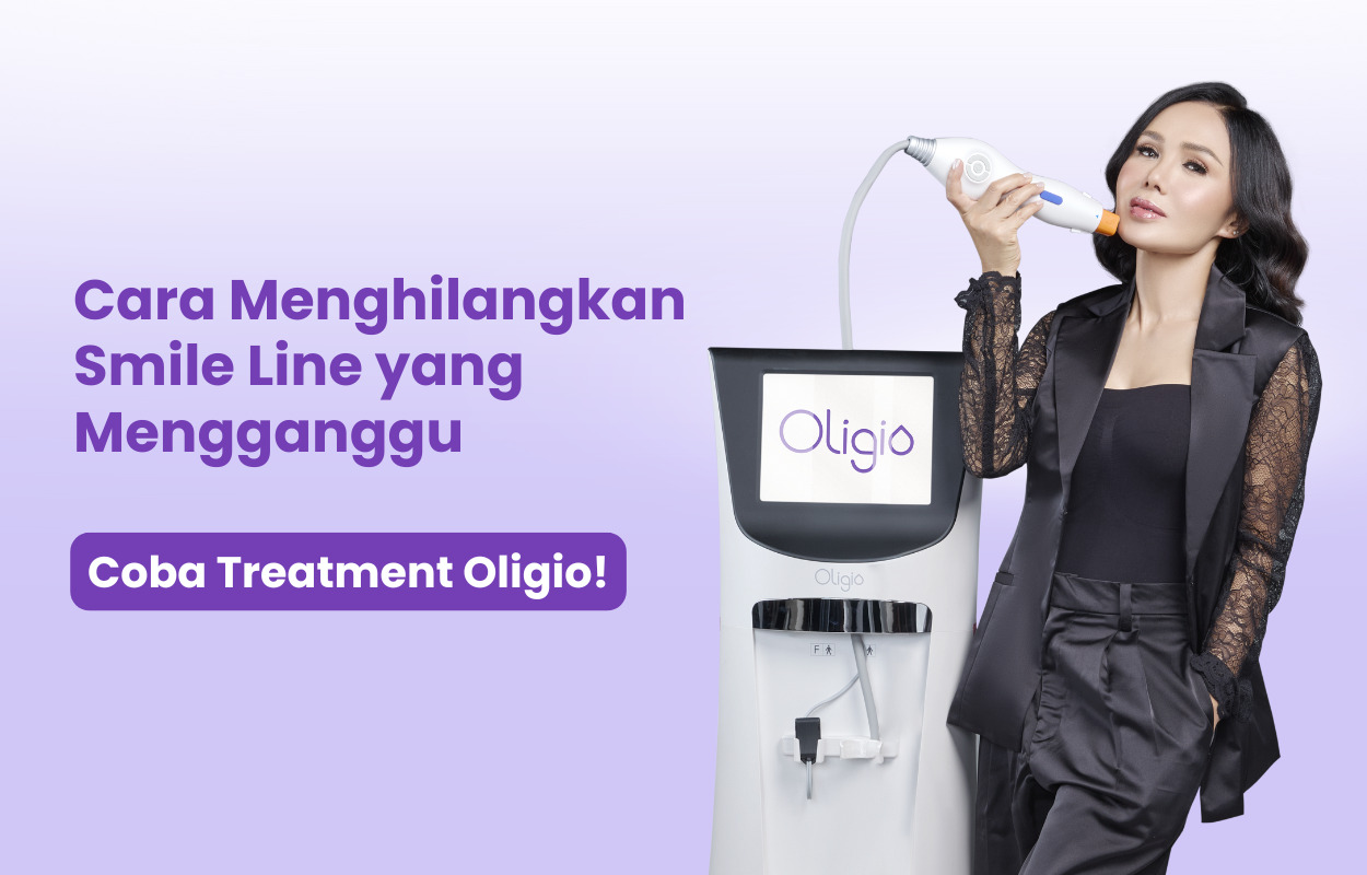 10 Cara Menghilangkan Smile Line Secara Alami dan Treatment Oligio - ST ...