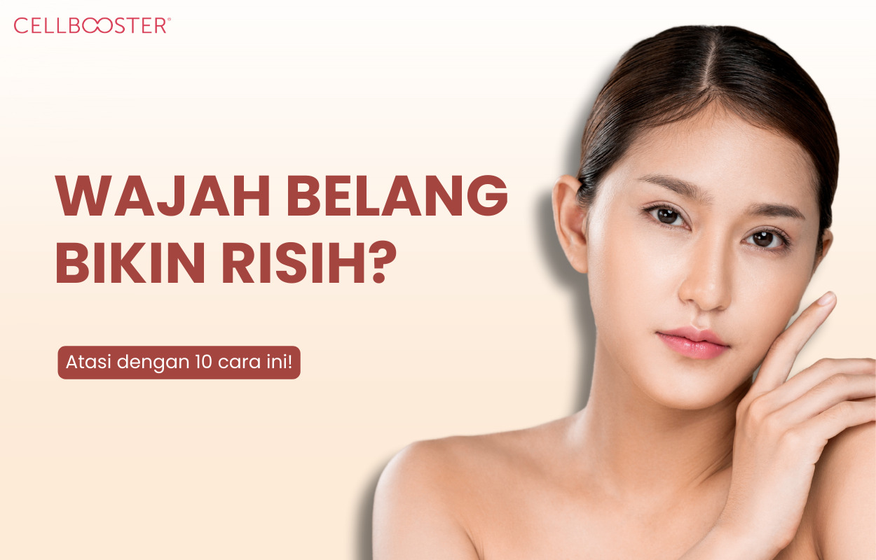 Kulit Wajah Belang? Ini 9 Cara yang Bisa Membantu Mengatasinya - ST ...