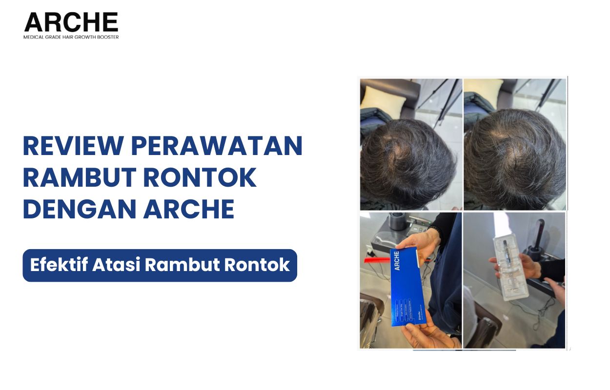 Review Perawatan Rambut Rontok dengan ARCHE Medical Grade Hair Growth ...