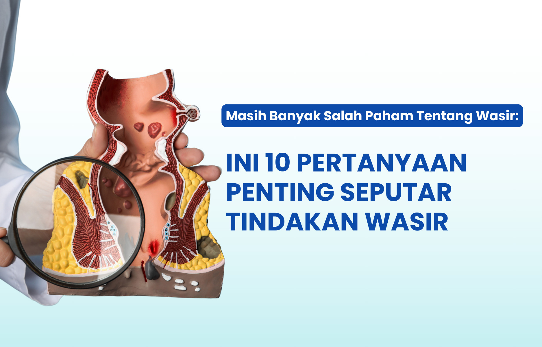 Masih Banyak yang Salah Paham Tentang Wasir: Ini 10 Pertanyaan Penting ...