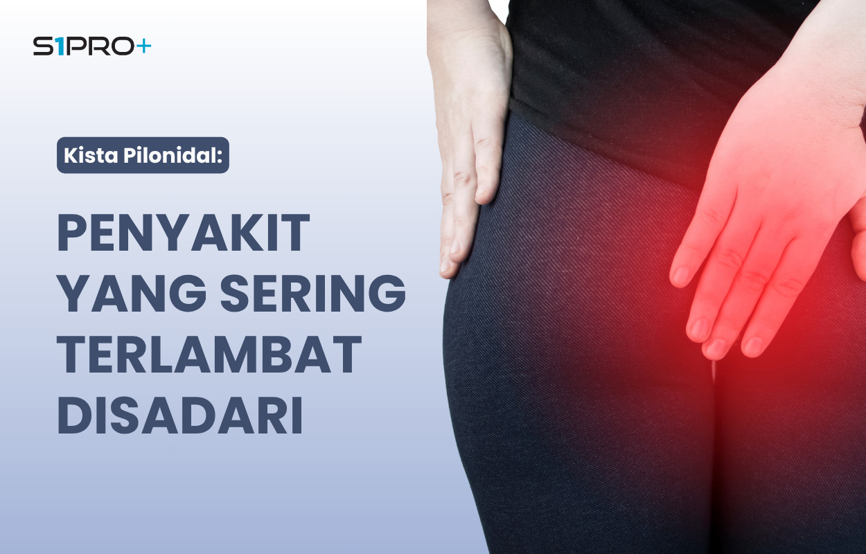 Kista Pilonidal: Penyakit yang Sering Terlambat Disadari - ST Indonesia